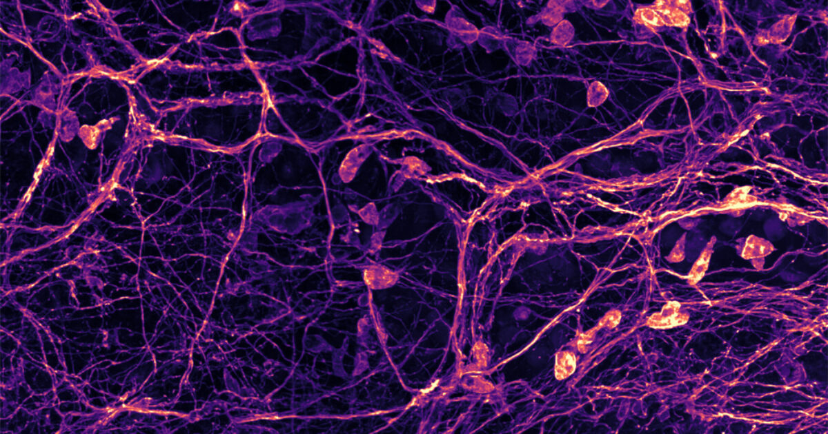 Five facts about memory and… | Stowers Institute for Medical Research