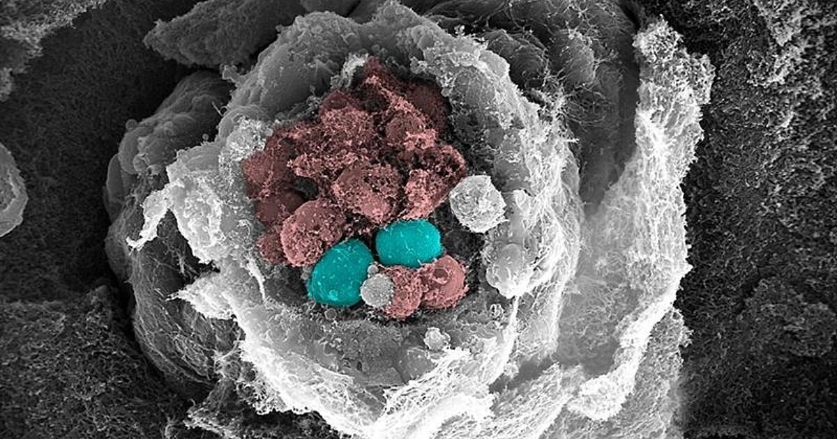 A niche for cancer | Stowers Institute for Medical Research