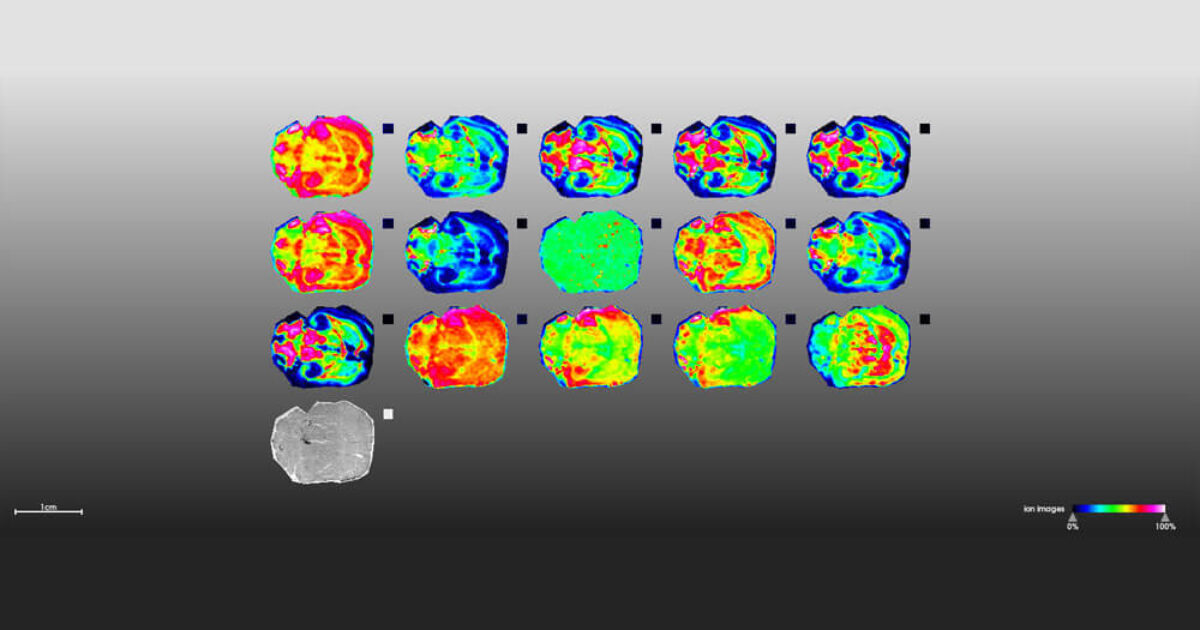#TechTalk: New Technology at… | Stowers Institute for Medical Research