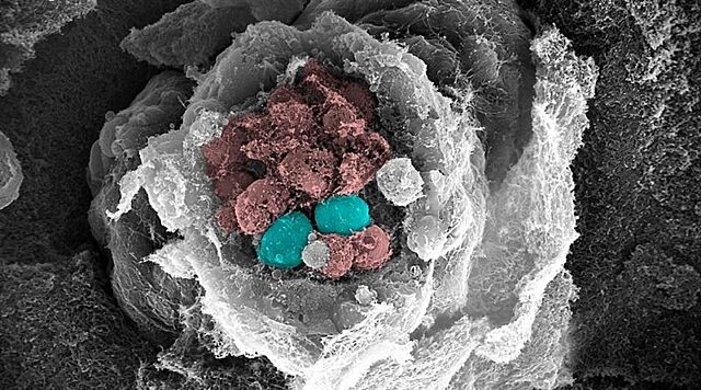 A niche for cancer | Stowers Institute for Medical Research